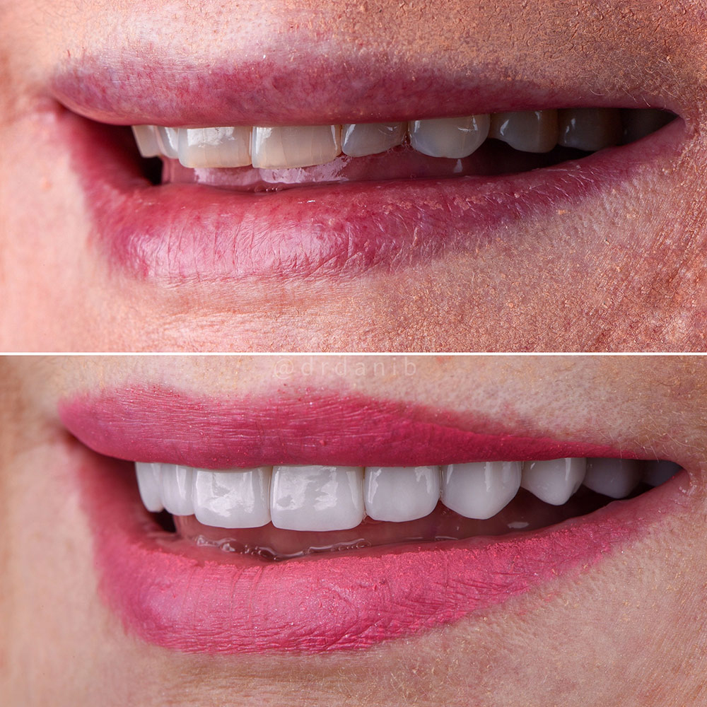 Cosmetic Dentistry | IdealMC